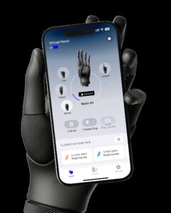 Ukrainian Esper Bionics Releases New Version of Esper Hand 2 Bionic ...